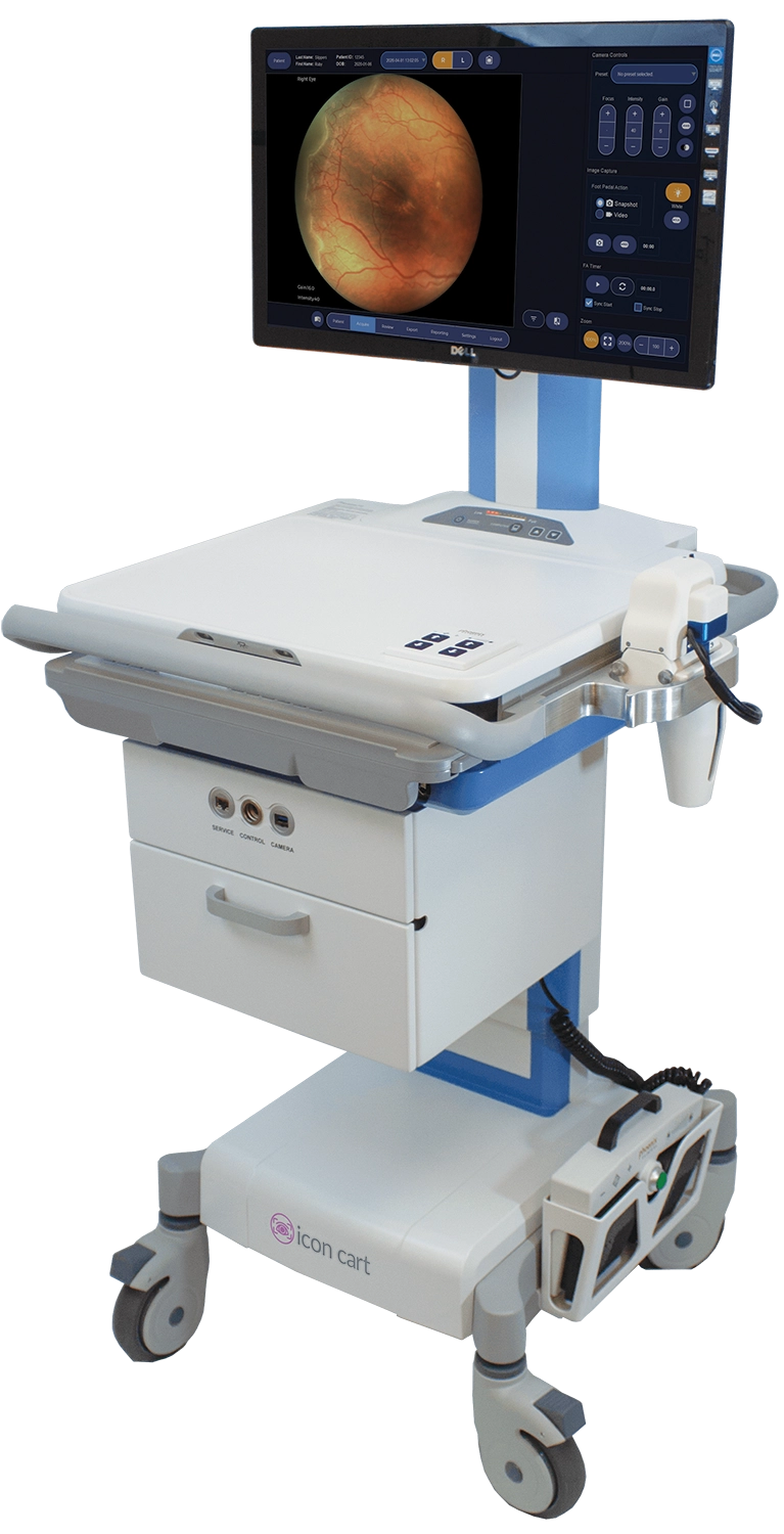 Icon Retinal Imaging System